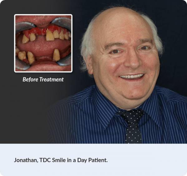 Jonathan Winton 's Smile in a Day | TDC Implant Centres