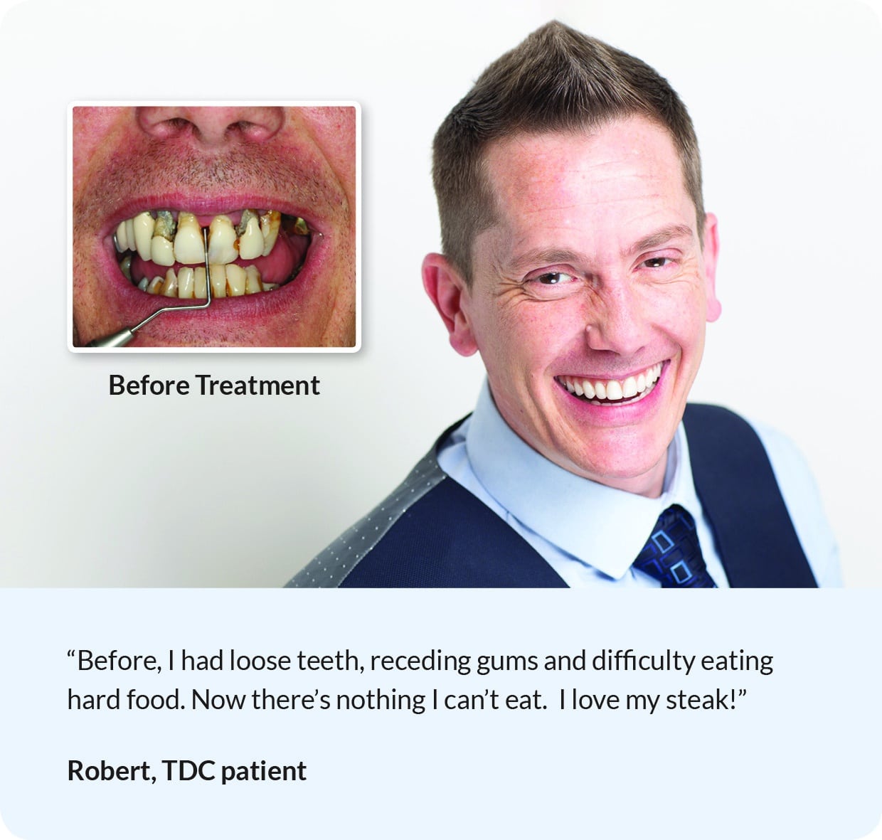 Robert's Smile in a Day | TDC Implant Centres