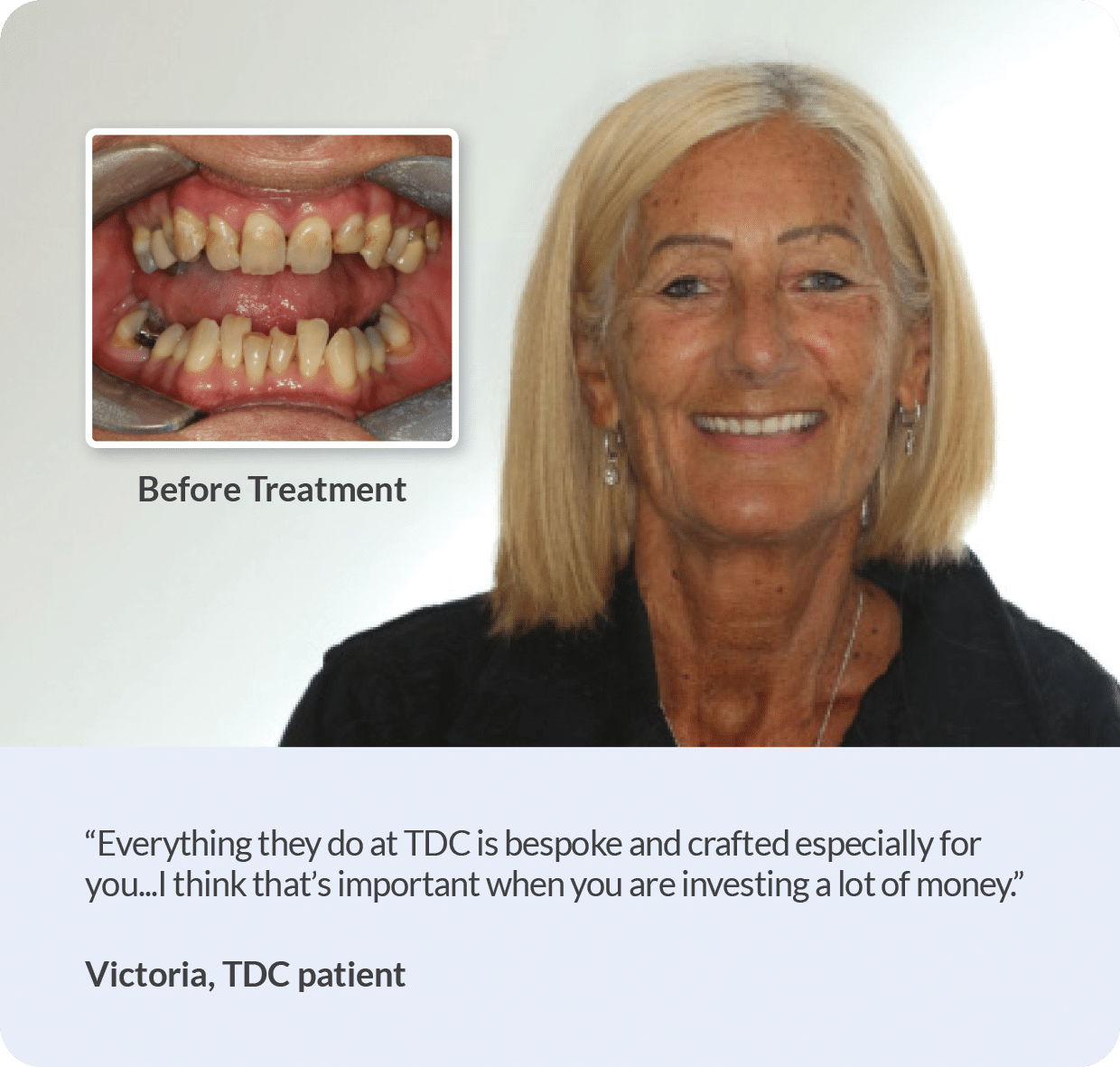 Tracy Sewell's New Smile | TDC Implant Centres
