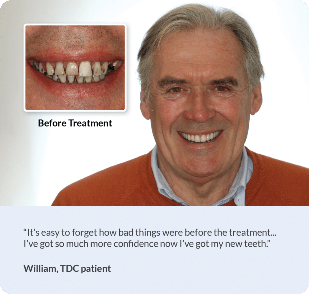 William's Smile in a Day Case Study | TDC Implant Centres