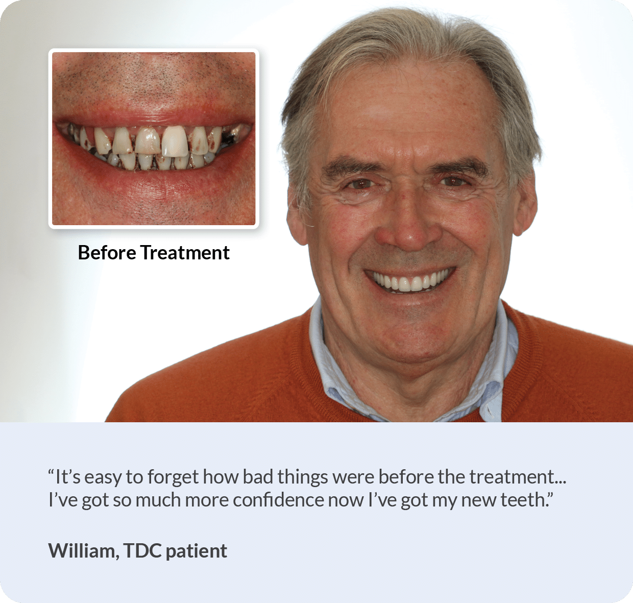 William's Smile in a Day Case Study | TDC Implant Centres